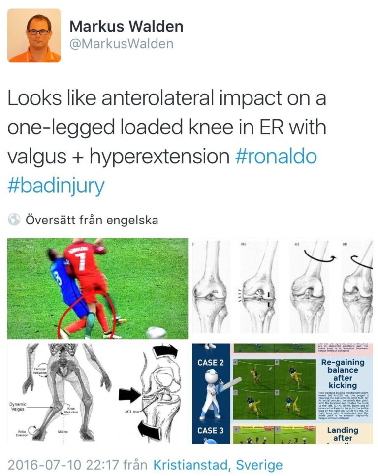 Surprisingly great interest for an MCL sprain - Cristiano Ronaldo and ...