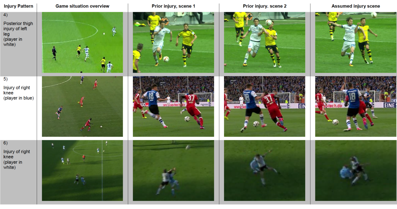 How do football injuries occur? Nine typical injury patterns from ...