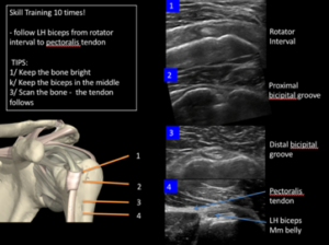 Where to start with Musculoskeletal Ultrasound? 5 #TopTips! - BJSM blog ...