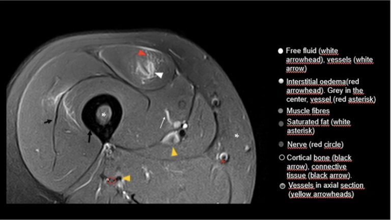 A Beginners Guide to Musculoskeletal MRI - BJSM blog - social media's ...