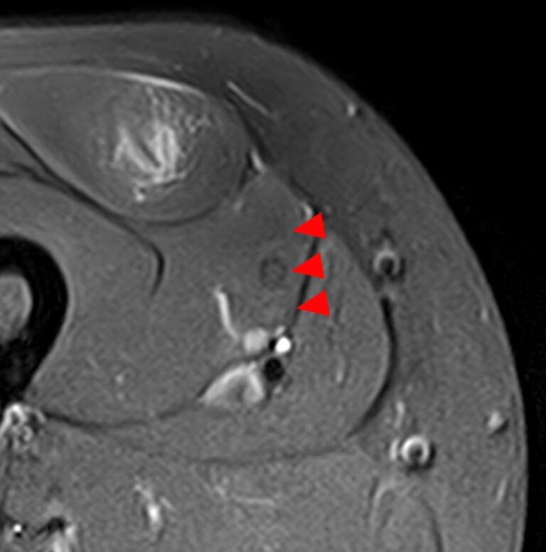 A Beginners Guide to Musculoskeletal MRI - BJSM blog - social media's ...