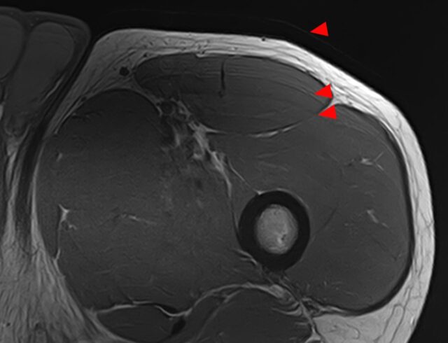 A Beginners Guide to Musculoskeletal MRI - BJSM blog - social media's ...