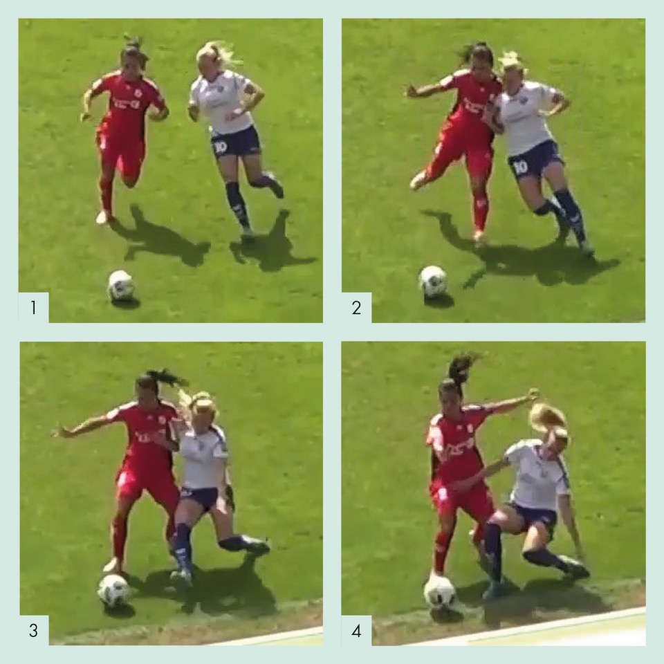 Main injury patterns for ACL injuries in female football players - BJSM ...