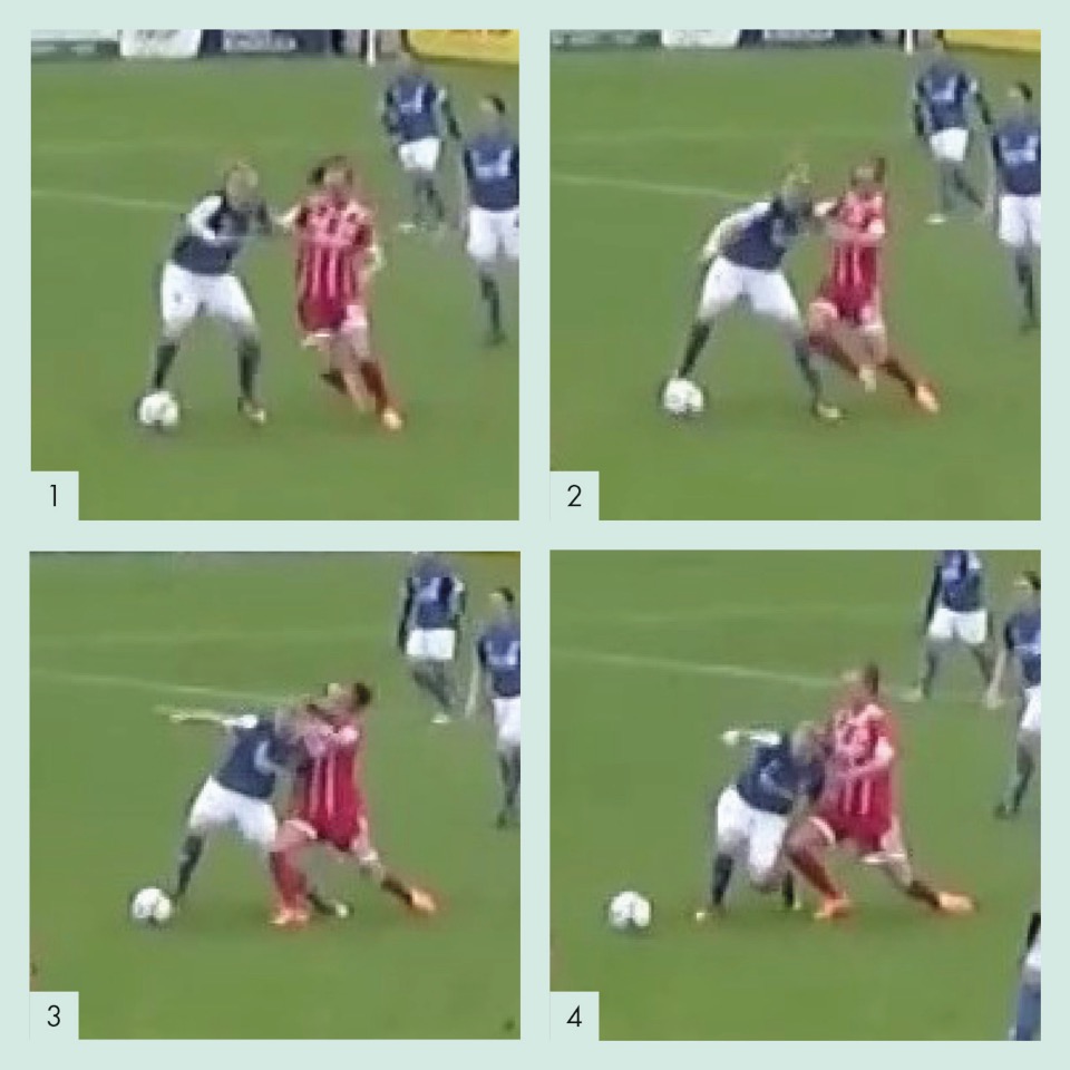 Main injury patterns for ACL injuries in female football players - BJSM ...