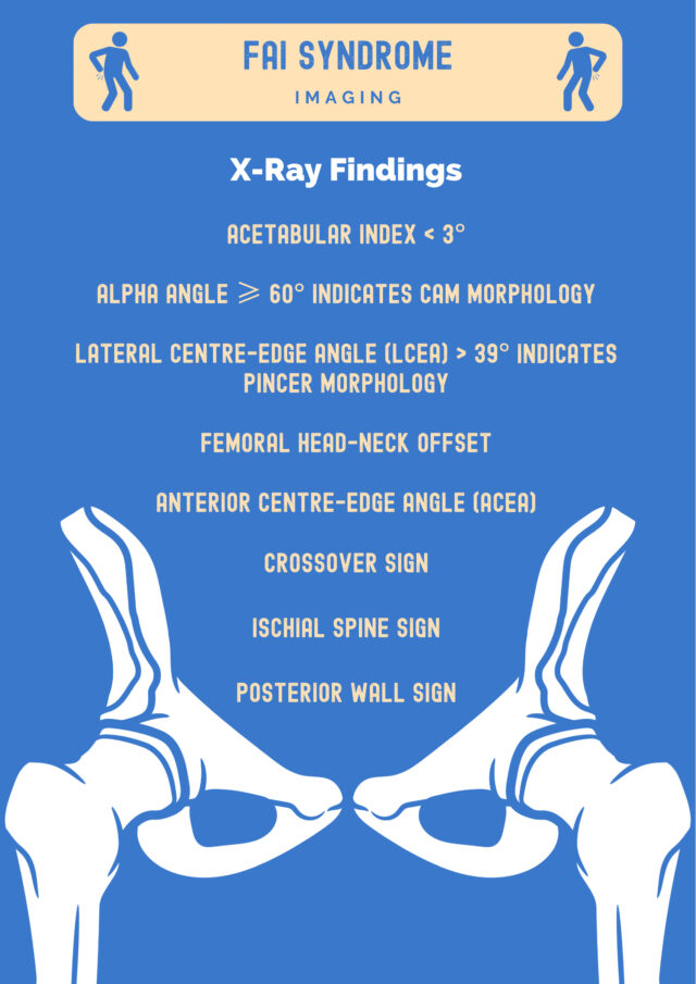 The MSK Playbook - Femoral Acetabular Impingement Syndrome - BJSM blog ...