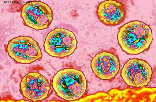Nir Eyal Risky Yet Socially Important Clinical Trials—the Case Of Hiv Cure Related Research