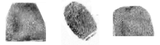 Jeffrey Aronson: When I use a word . . . Fingerprints - The BMJ