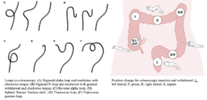 #FGBlog: New colonoscopy training pathway and certification: will we ...