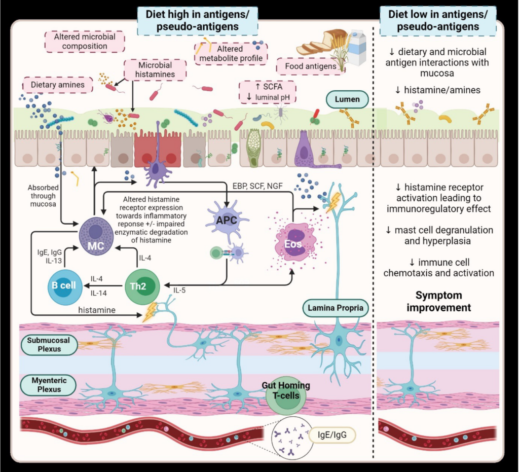#GUTBlog: Postprandial symptoms in disorders of gut-brain interaction ...