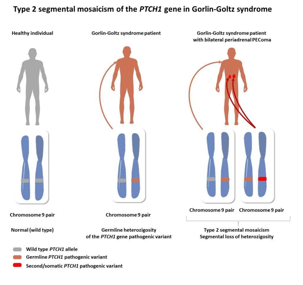 Surprising genetic and pathological findings in a patient with giant ...
