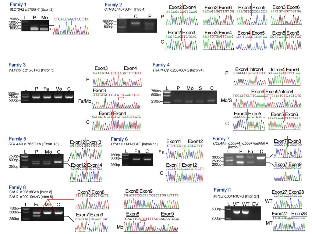 RNA splicing analysis contributes to reclassifying variants of ...