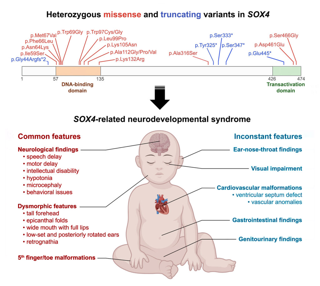 Consolidation of the clinical and genetic definition of a SOX4-related ...