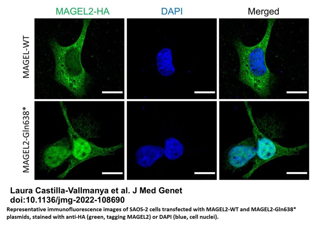 Advancing in Schaaf-Yang syndrome pathophysiology: from bedside to ...
