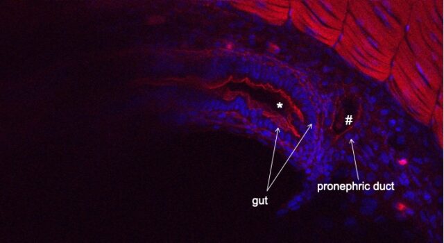 X-linked variations in SHROOM4 are implicated in multiple congenital ...