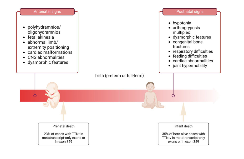The crucial role of titin in fetal development: recurrent miscarriages ...