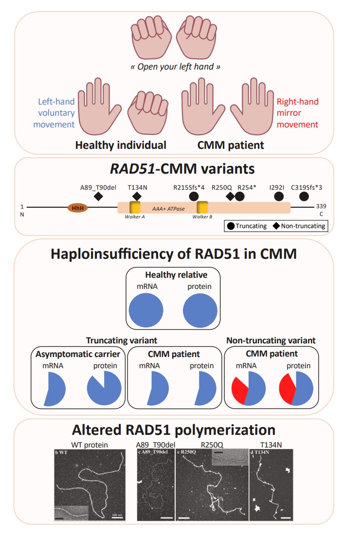 Congenital mirror movements are associated with defective ...