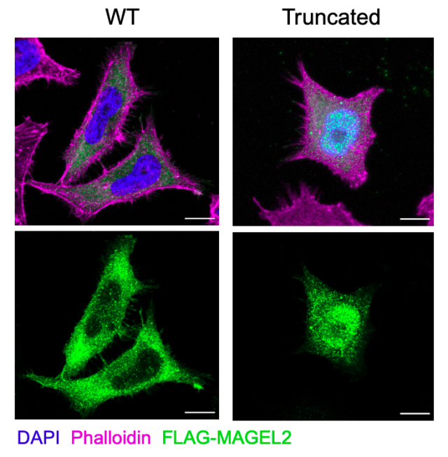 Subcellular localisation of truncated MAGEL2 proteins: insight into the ...