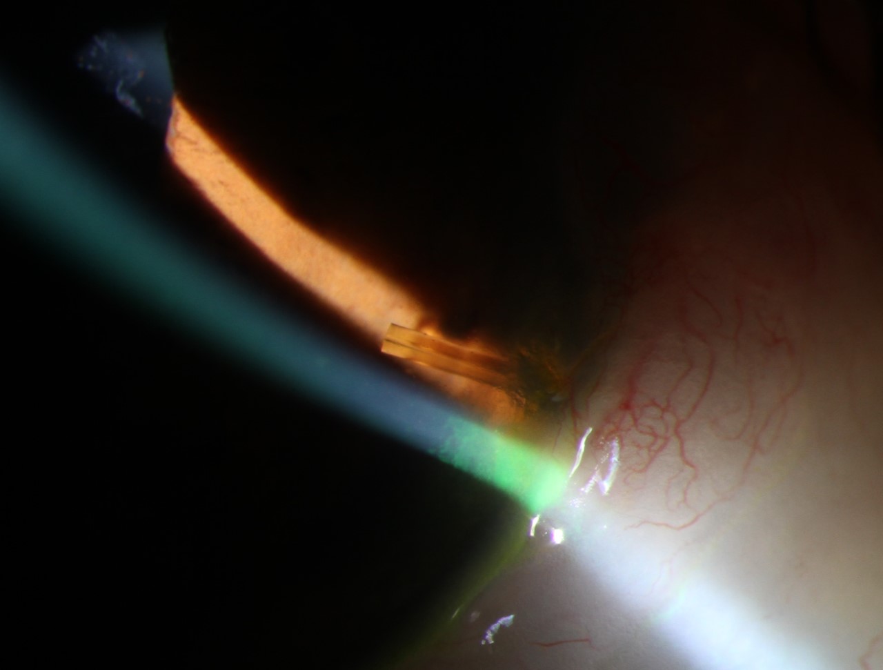 Vivisection Through the Eyes of Wilkie Collins, H.G. Wells and John ...